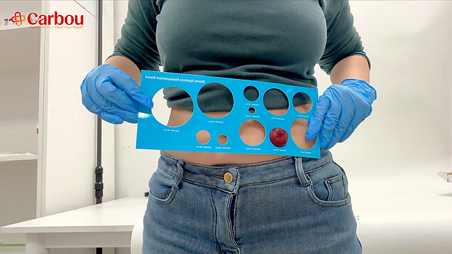 How to Measure Stoma Size: Quick Steps – Carbou