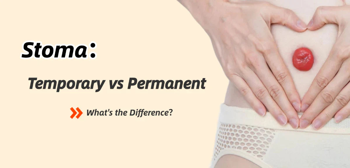 Temporary vs Permanent Stoma: Key Differences Explained – Carbou