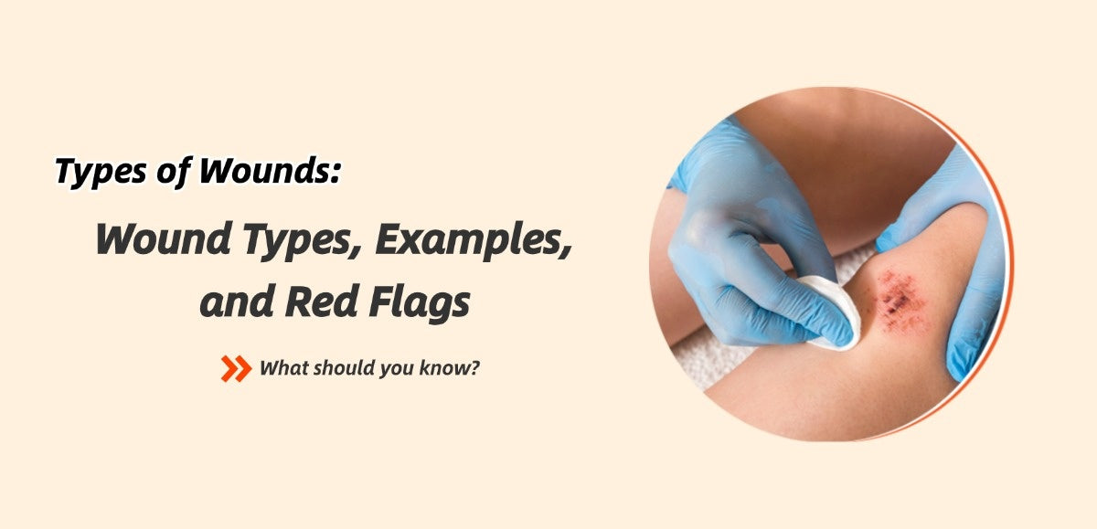 Wound Types Guide: Identify, Understand & Treat Wounds – Carbou