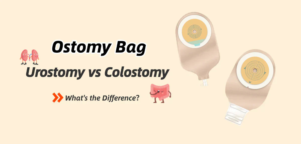 Urostomy Bags vs Colostomy Bags: Key Differences Explained – Carbou